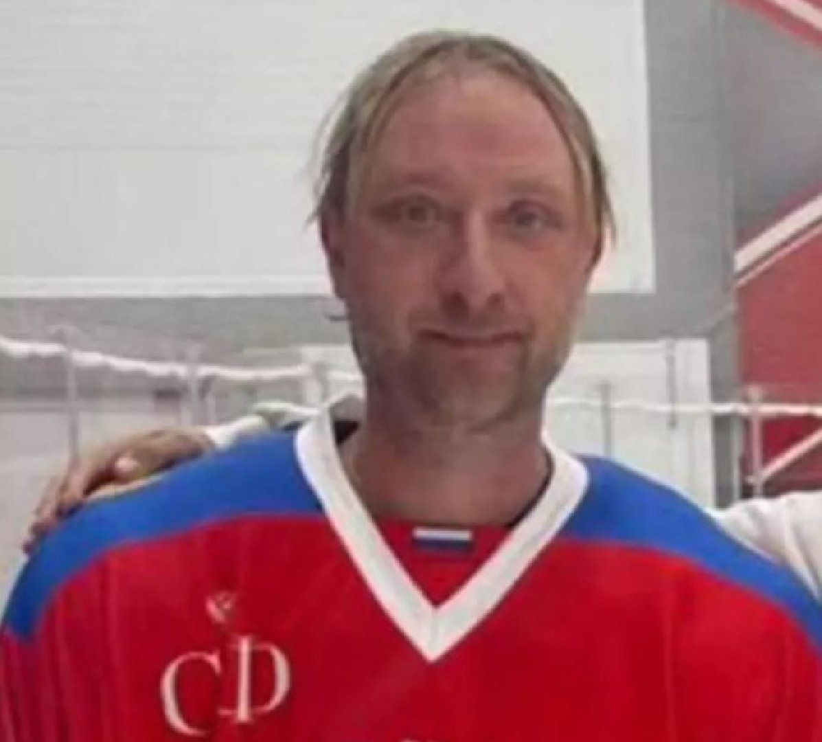 «Глаза натянули на затылок»: Плющенко показал обновлённую внешность ...